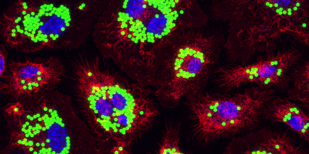 Inflammation & Immunity | Lerner Research Institute