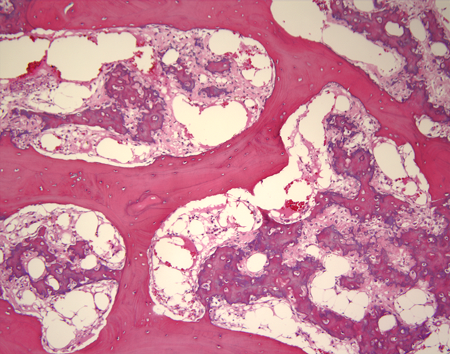 Research Musculoskeletal Research | Lerner Research Institute