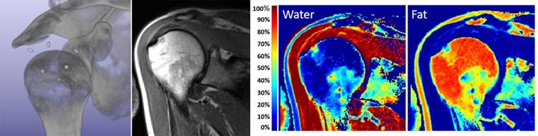 Research Musculoskeletal Research | Lerner Research Institute