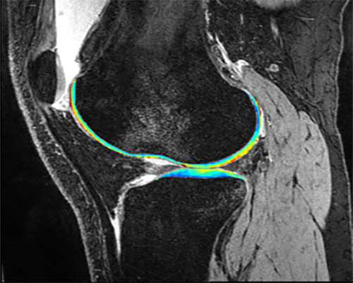 Research Musculoskeletal Research | Cleveland Clinic Research